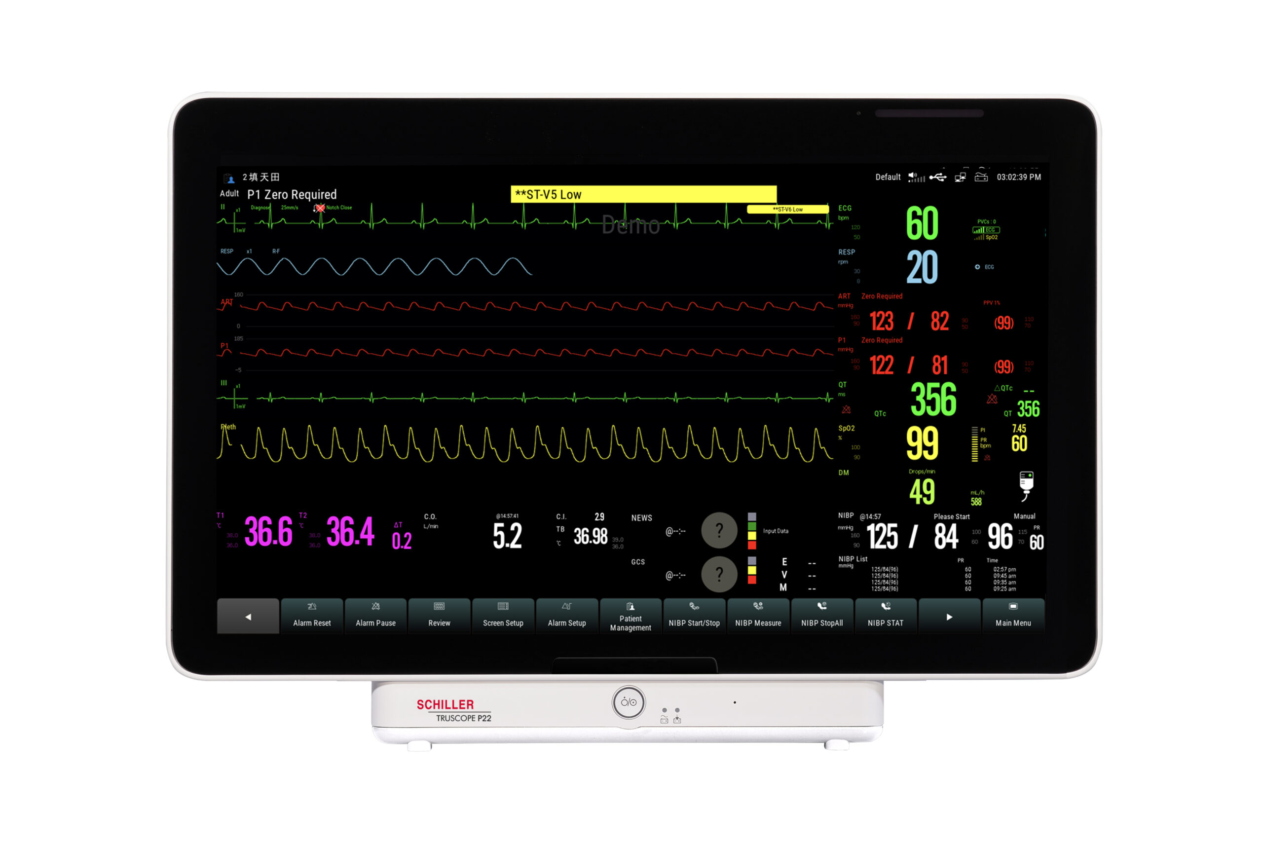 TRUSCOPE P Series – SCHILLER