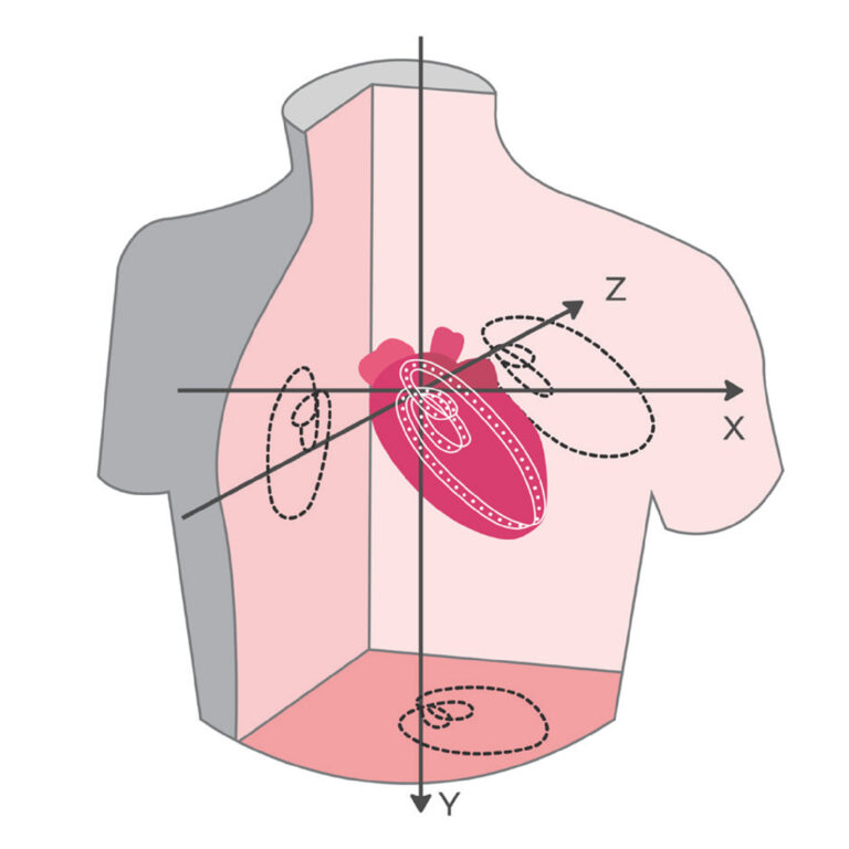 Vector ECG – SCHILLER
